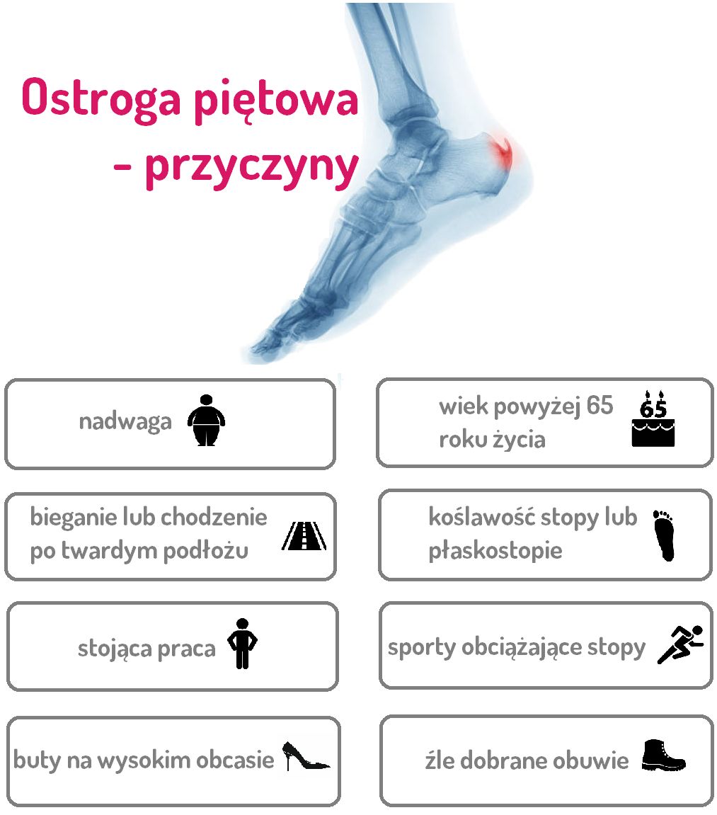 Ostroga piętowa Jak wyleczyć objawy w 3-6 tyg. ? [PORADNIK]